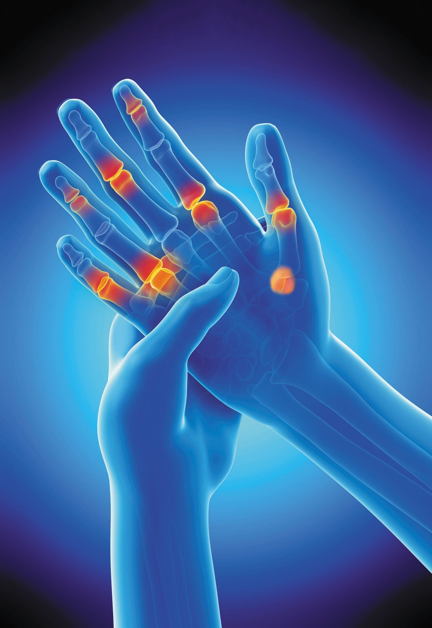What’s Actually Damaged When Your Fingers Hurt After a Gi Jiu-Jitsu Sp ...